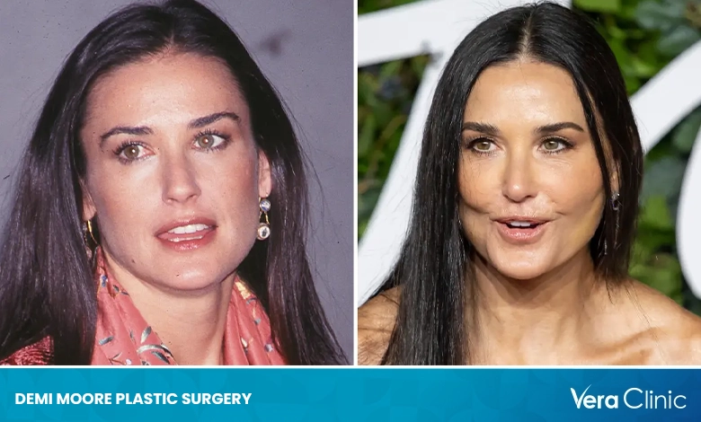 Demi Moore Plastic Surgeries, Before and After