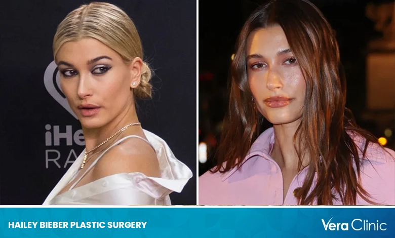 Hailey Bieber Plastic Surgeries, Before and After
