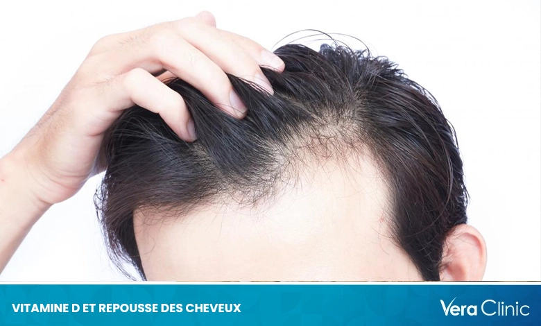 Exploration du lien entre la Vitamine D repousse cheveux