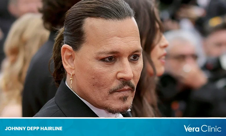 depp plastic surgery