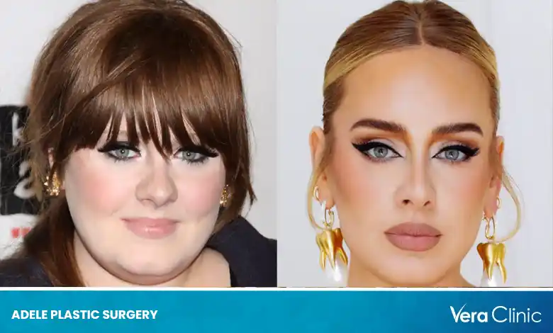 Adele Plastic Surgeries, Before and After