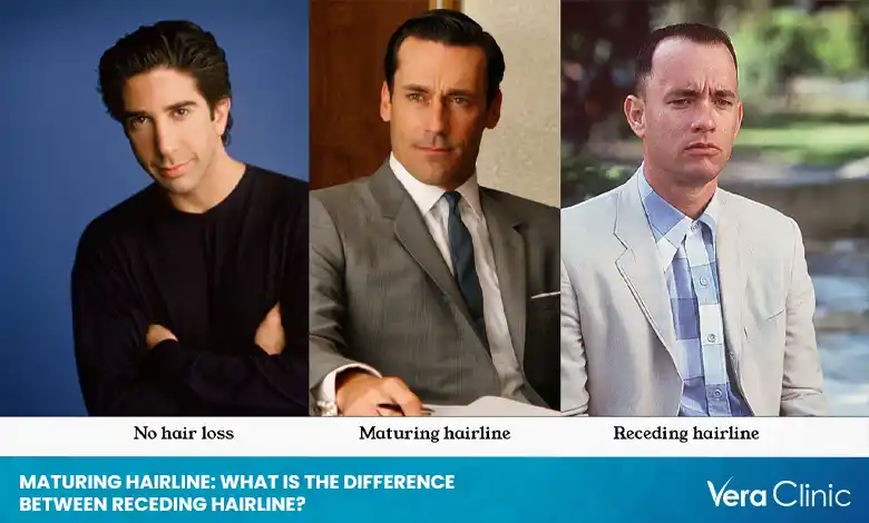 Maturing Hairline: What Is the Difference Receding Hairline?