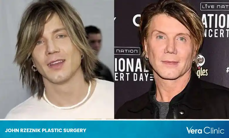John Rzeznik’s Plastic Surgeries, Before and After