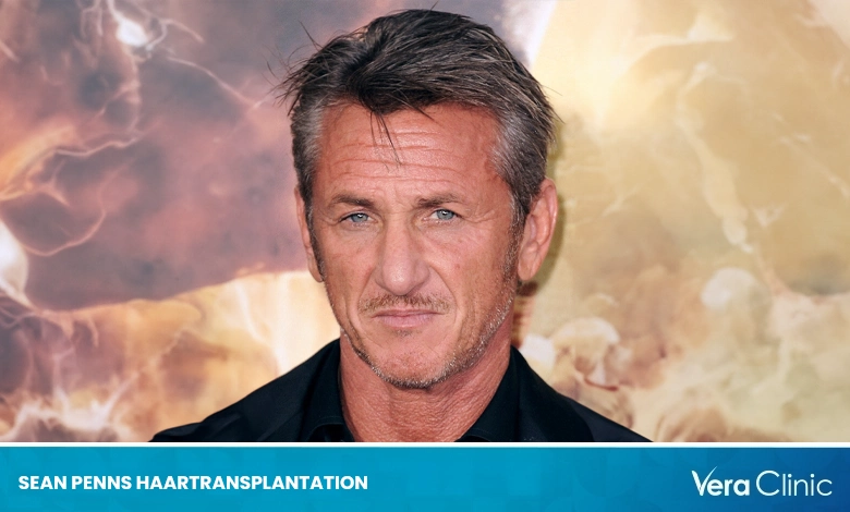 Sean Penns Haartransplantation: Eine Geschichte der Transformation mit ...