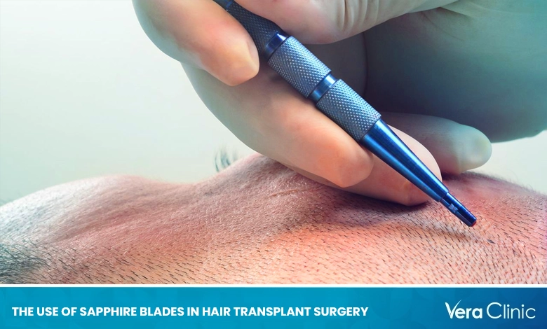 The Use of Sapphire Blades in Hair Transplant Surgery