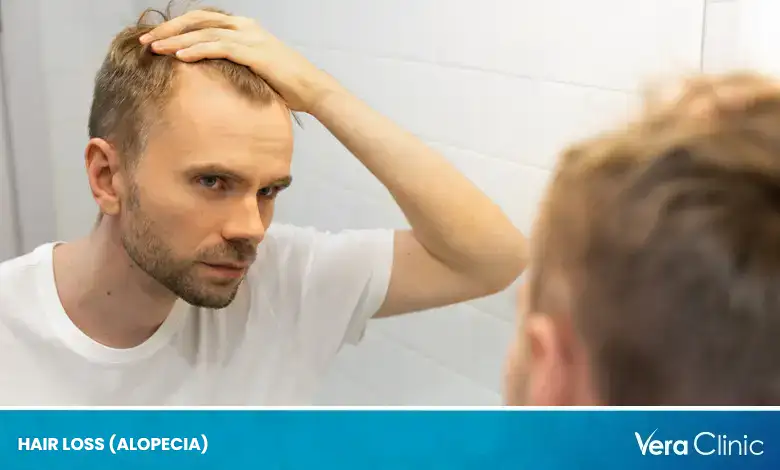 Pérdida de cabello (alopecia): signos, causas y tratamientos - Vera Clinic