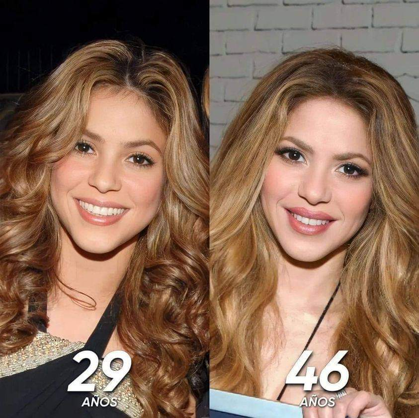 Shakira Plastic Surgery : Is It Real or Fake?