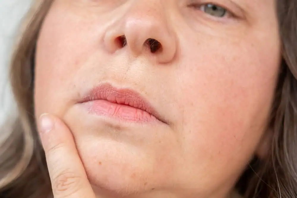 Fine Lines Showing Up? Jeuveau Might Be Your Answer - Rachel Bustin