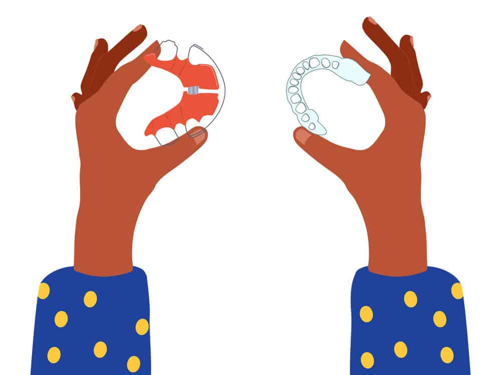 Clear Retainers vs Wire Retainers: Durability, Comfort, and Maintenance ...