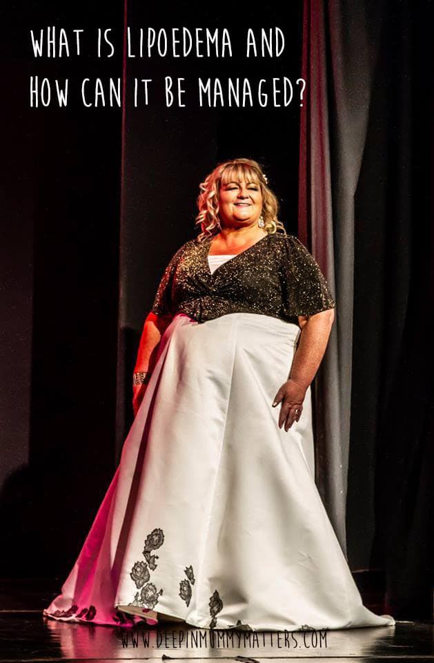 What is Lipoedema and how can it be managed? - Mummy Matters