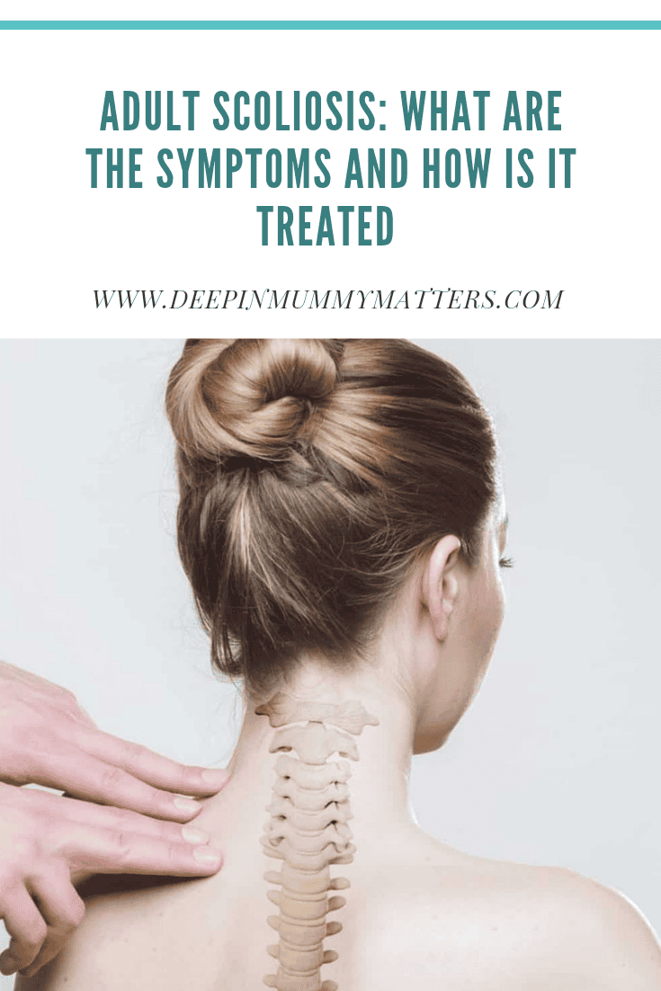 Adult Scoliosis: What Are The Symptoms And How Is It Treated - Mummy ...