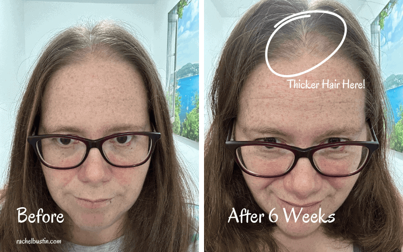 CurrentBody Helmet Review: Cutting-Edge LED Therapy For Hair Regrowth ...