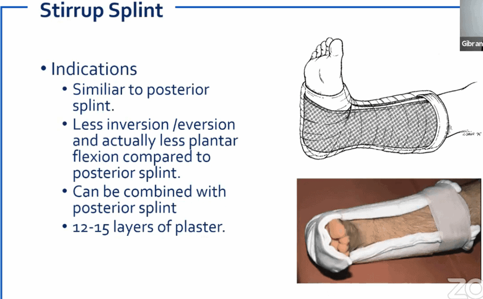Catatan Koas2Doctor: Orthopaedic Webinar Class – Orthopaedi dan ...